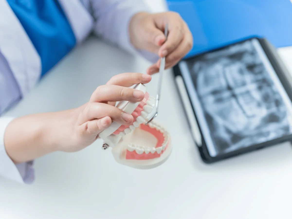 10 Things I Wish I Knew Before Getting Dental Implants: A Patient's Guide