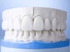 Fixing Protruding Front Teeth: A Complete Guide to Your Treatment Options