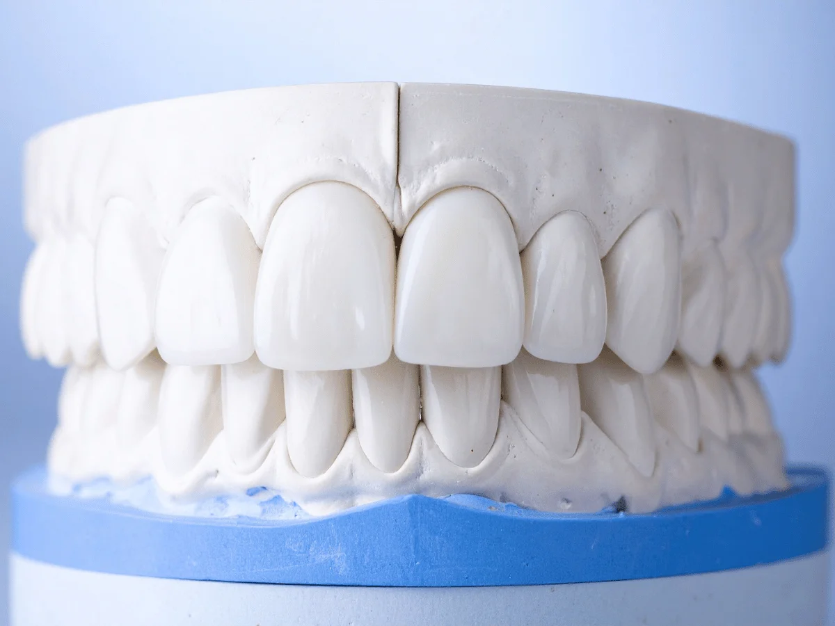 Fixing Protruding Front Teeth: A Complete Guide to Your Treatment Options