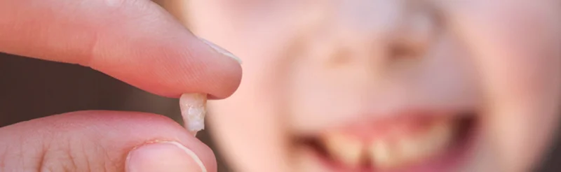 What to do When Your Tooth Falls Out