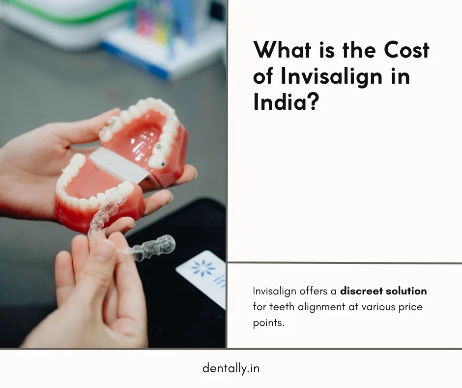 What is the Cost of Invisalign in India?